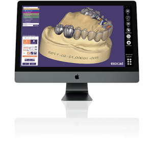 exocad DentalCAD - Nowak Digital
