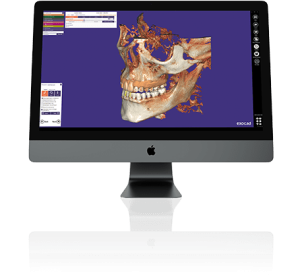 DICOM Viewer - Nowak Digital